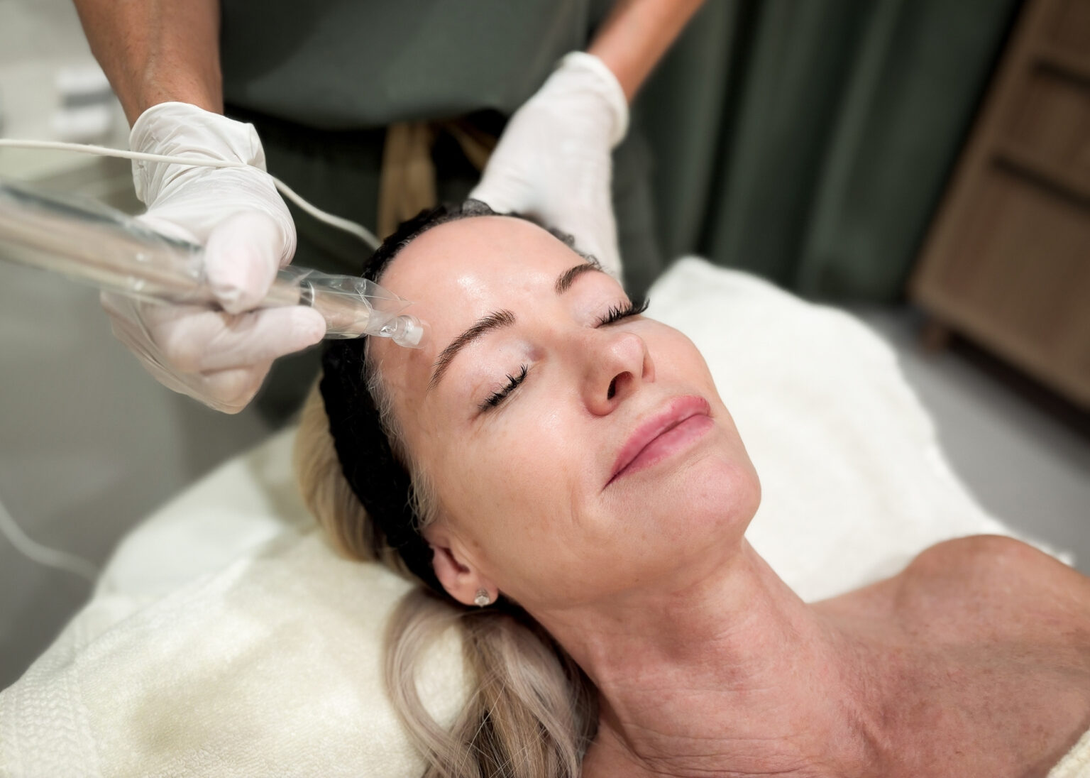 Microneedling in Naples | Von & Co Medical Aesthetics Studio