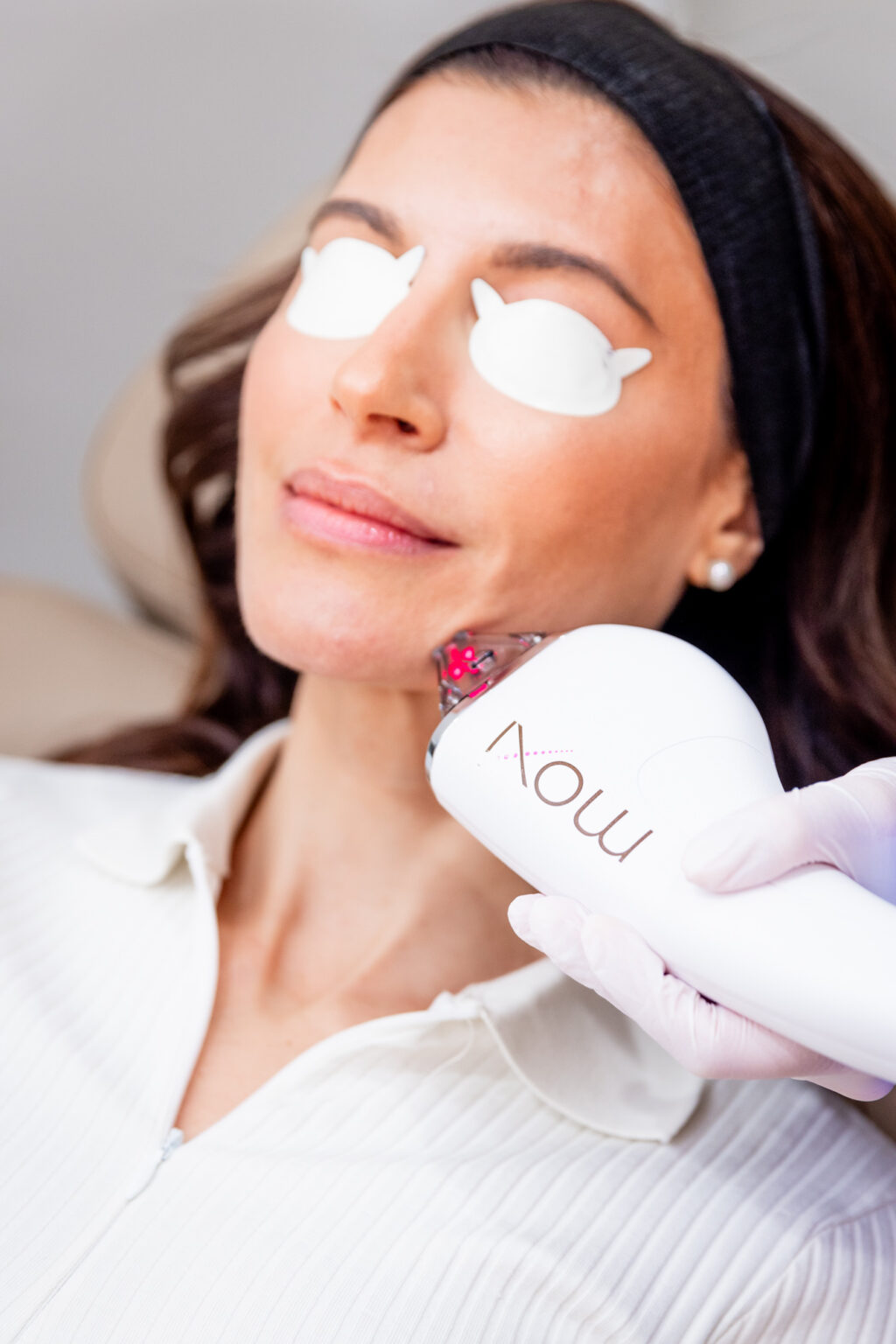 Moxi Laser in Naples | Von & Co Medical Aesthetics Studio